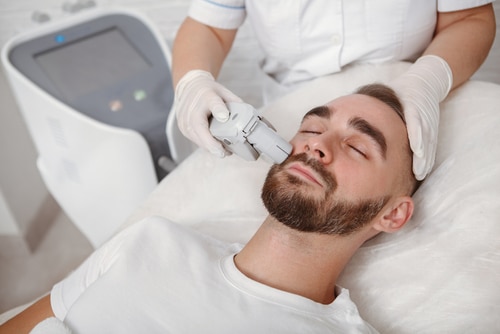 Thinning The Beard Romeo And Juliette Laser Hair Removal